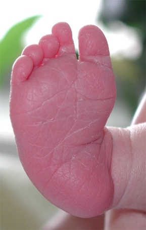 Images - soigner un pied bot