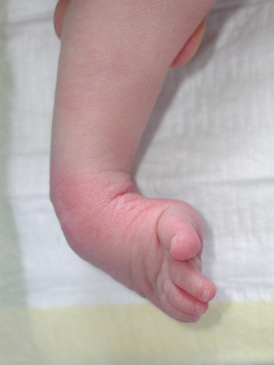 test - soigner un pied bot